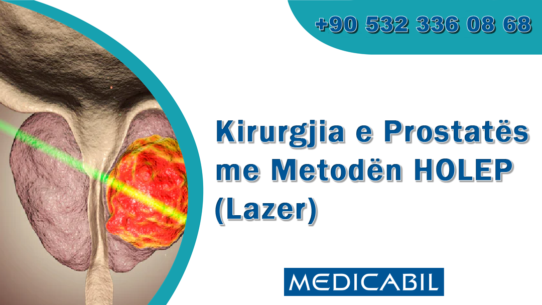 Kirurgjia e Prostatës me Metodën HOLEP (Lazer) | Bursa Özel Medicabil ...
